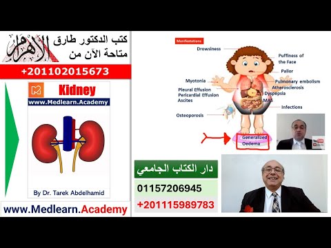 Nephrotic Syndrome    #cme #internal_medicine  #usmle #medical #محاضرات_باطنة