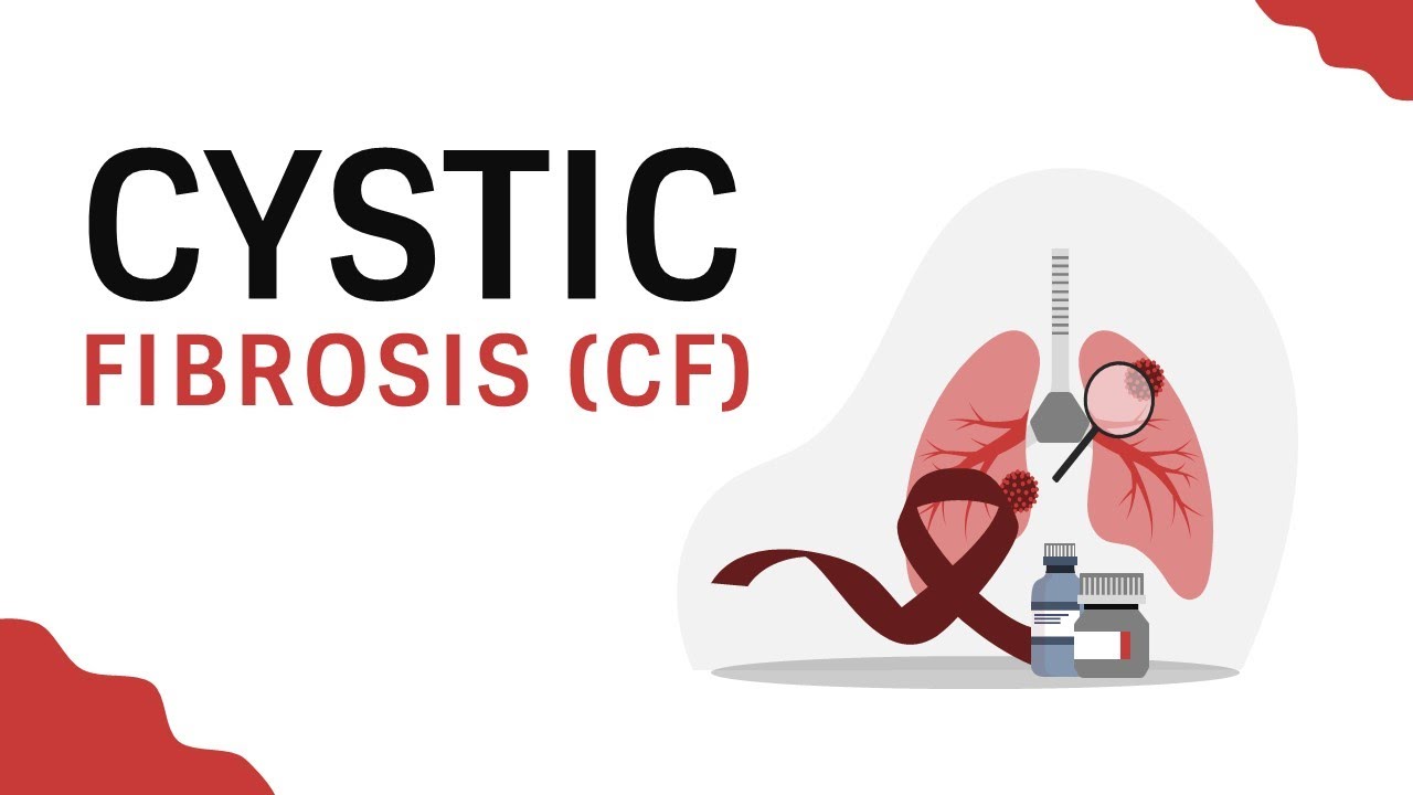 Cystic Fibrosis Animated Slides - YouTube