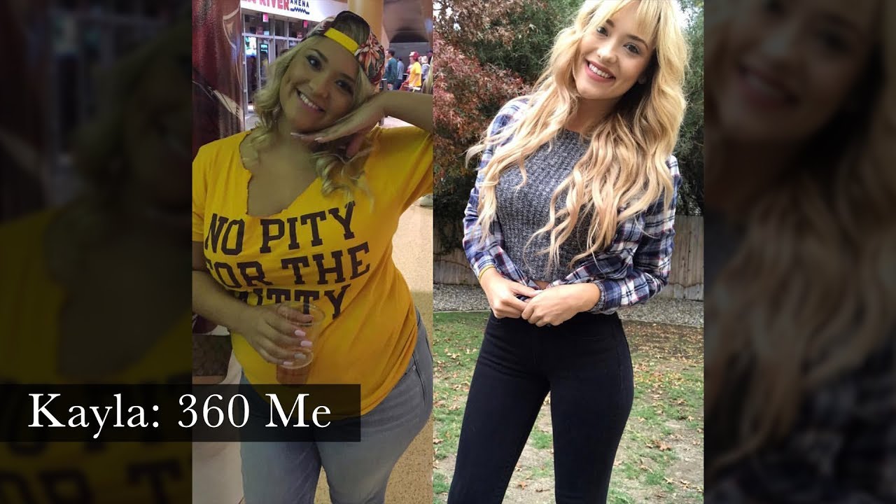 360 Body Lift after Losing 120 Pounds - Kayla: '360 Me' - YouTube
