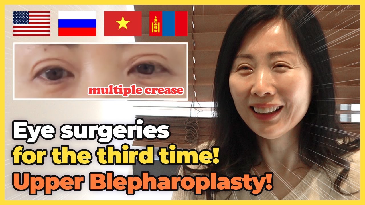 [Upper Blepharoplasty] Double Eyelid Surgery Review, Fix multiple ...