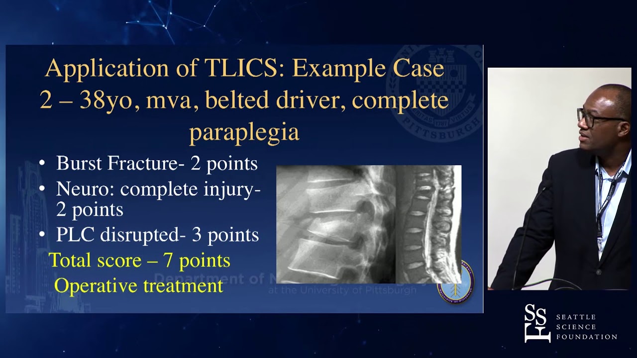 Essentials of Thorocolumbar Spine Trauma - D. Kojo Hamilton, MD - YouTube