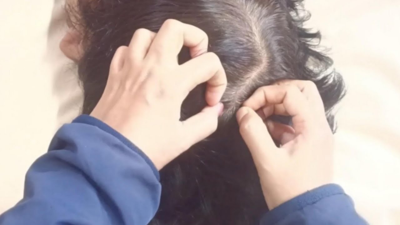 The Satisfaction of Scalp Inspections - YouTube