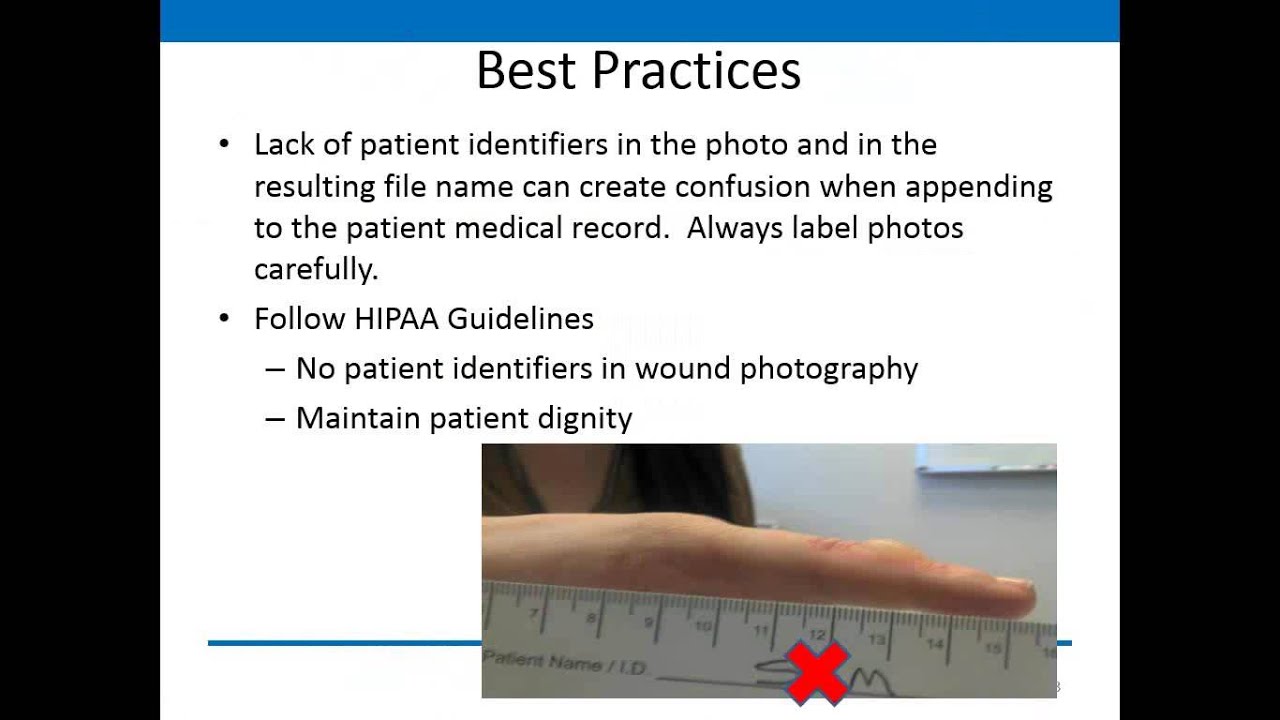 WoundRounds Webinar: Wound Photography for Risk Management - YouTube