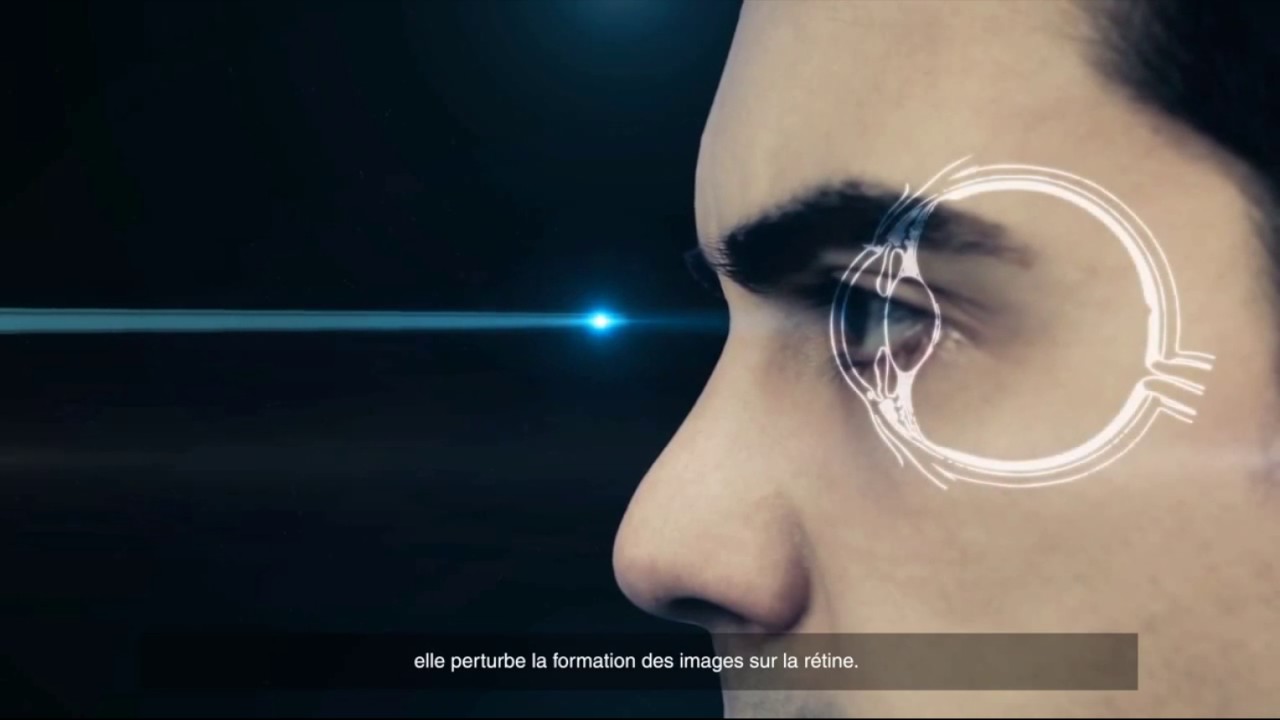 Effet de la lumière bleue sur les yeux - YouTube