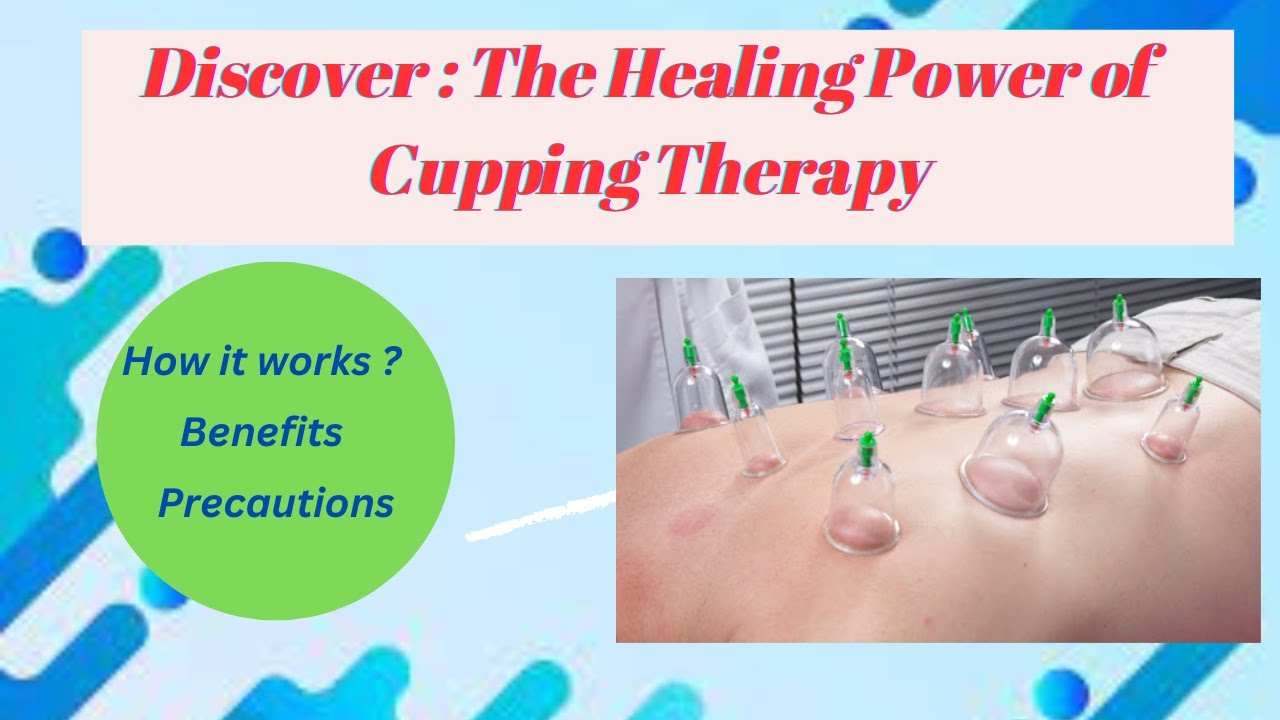 Cupping therapy/Hijama|How cupping therapy cure diseases? Benefits # ...