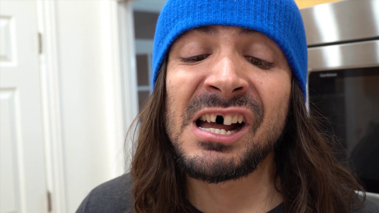 Tooth gets stuck in an apple 🤣 - YouTube