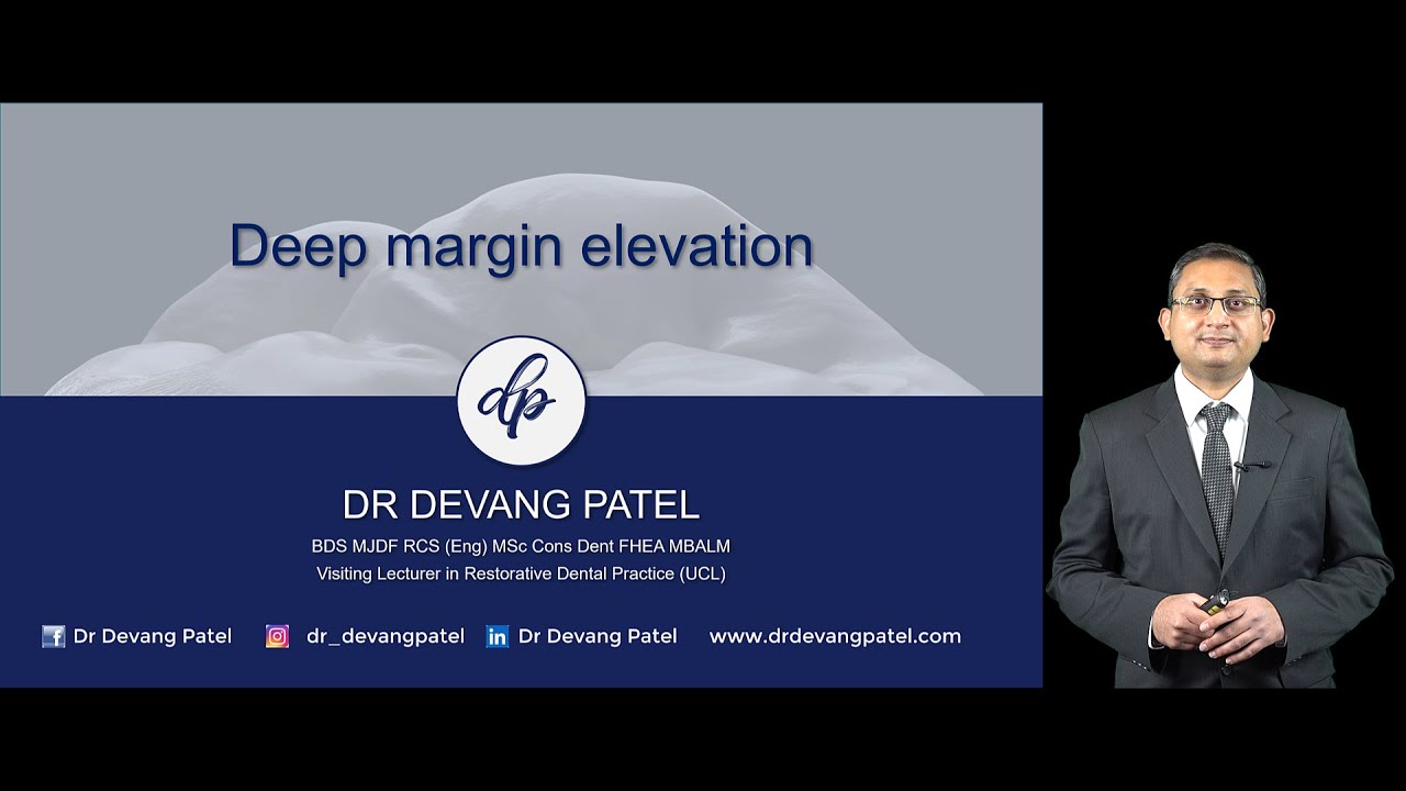 Deep Margin Elevation - YouTube