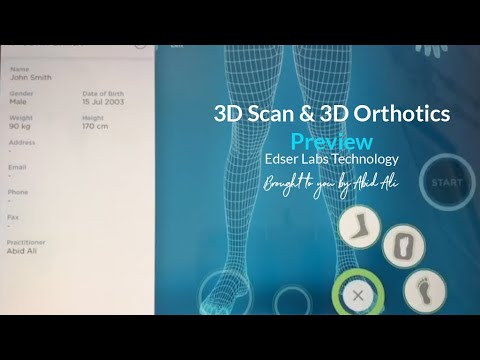 Demo Preview: 3D Printed Orthotics latest technology (by Edser Labs ...