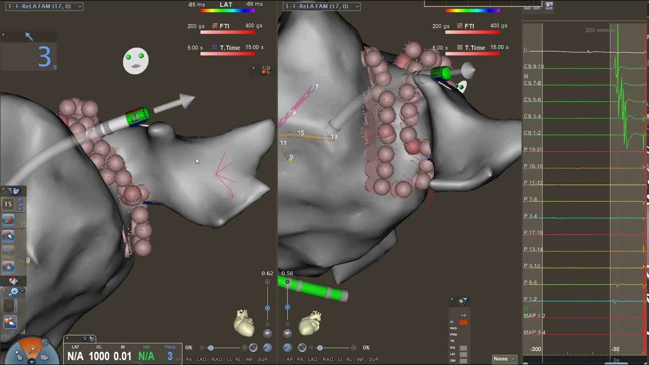 Escape Mapping - YouTube