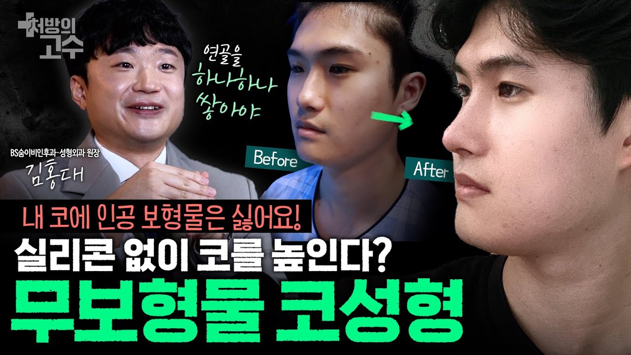 부산 코성형 실리콘 없이 코를 높이는 무보형물 코성형 Bs숨이비인후과·성형외과 김홍대 원장 Youtube