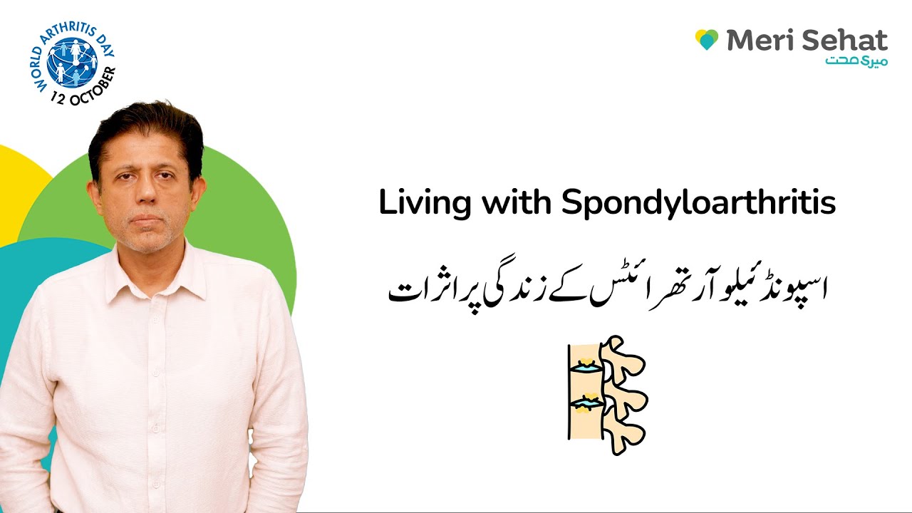 Living with Spondyloarthritis | Dr Shakaib Sajid Quraishi | World ...