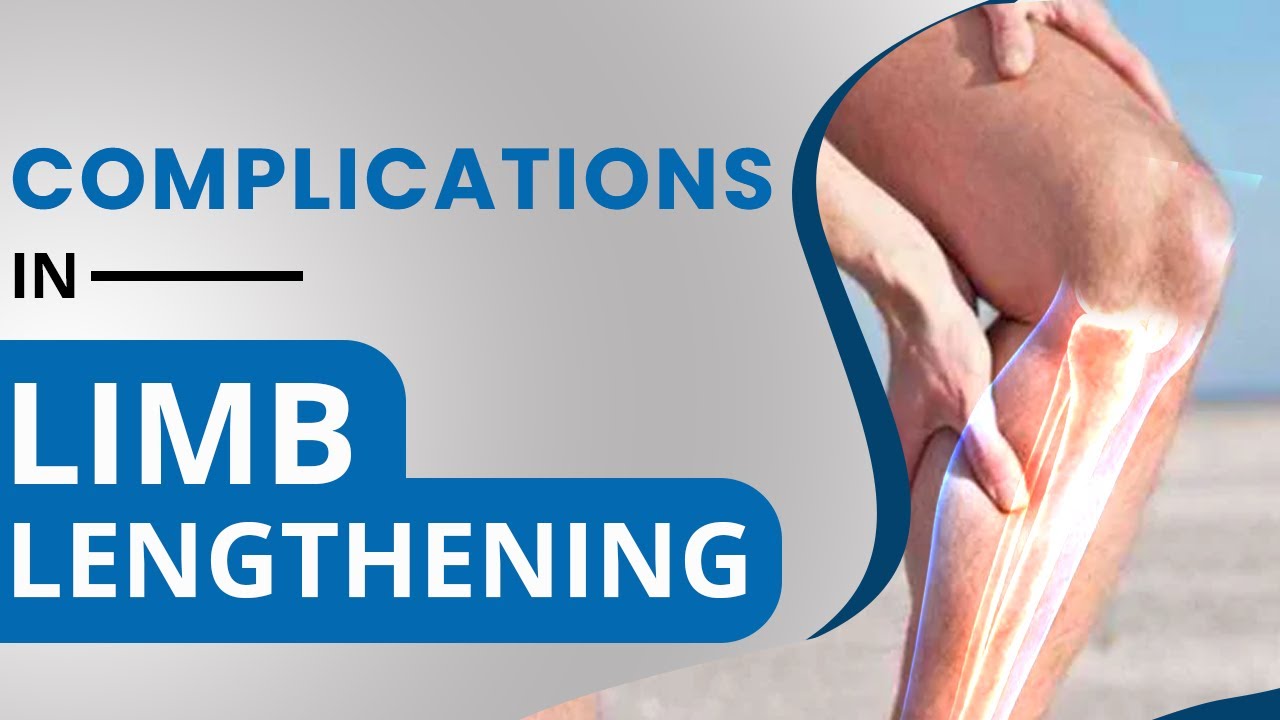 Complications in Limb Lengthening Surgery Complete Information by Dr ...