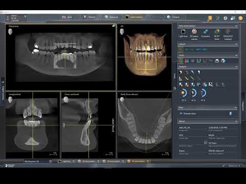 AXEOS 4 Fields of View - YouTube