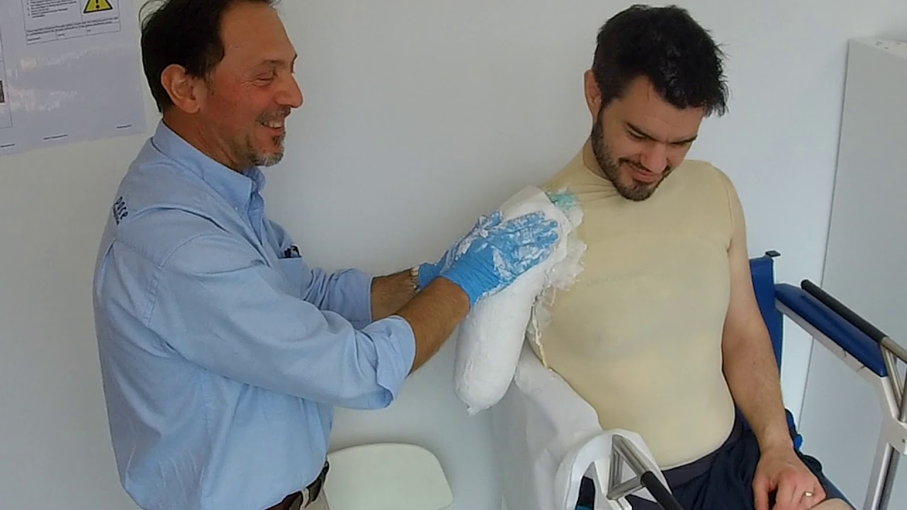 Pace Rehabilitation - Time lapse video of an above-elbow cast - YouTube