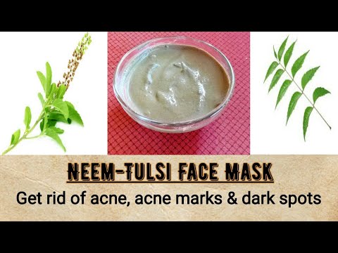 Homemade Neem-Tulsi Face Pack | Get rid of acne, acne marks, dark spots ...