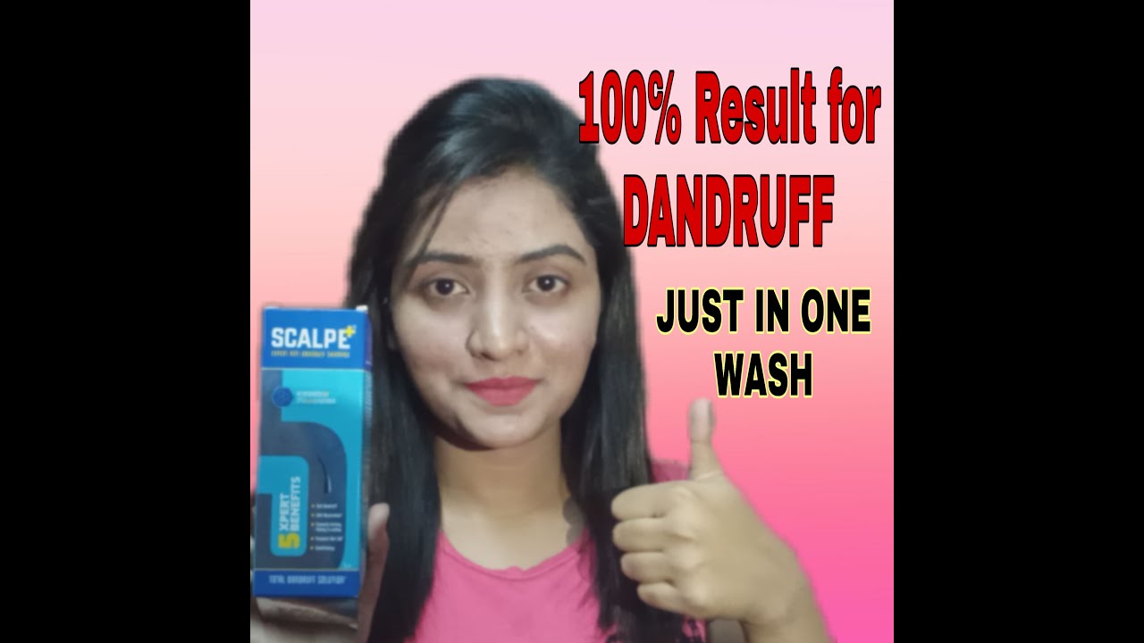 ANTI DANDRUFF SHAMPOO... Result in one wash for// Dandruff.. Hair Fall ...