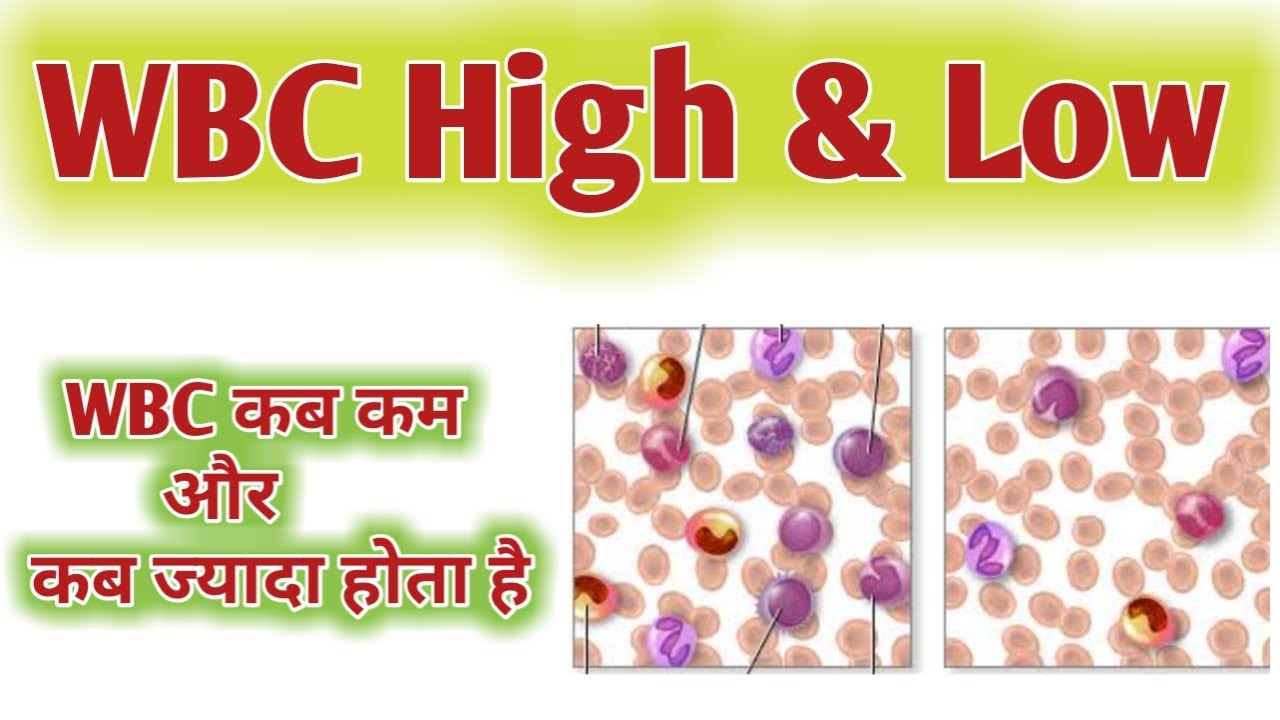 Symptoms of High WBC | Symptoms of Low WBC - YouTube