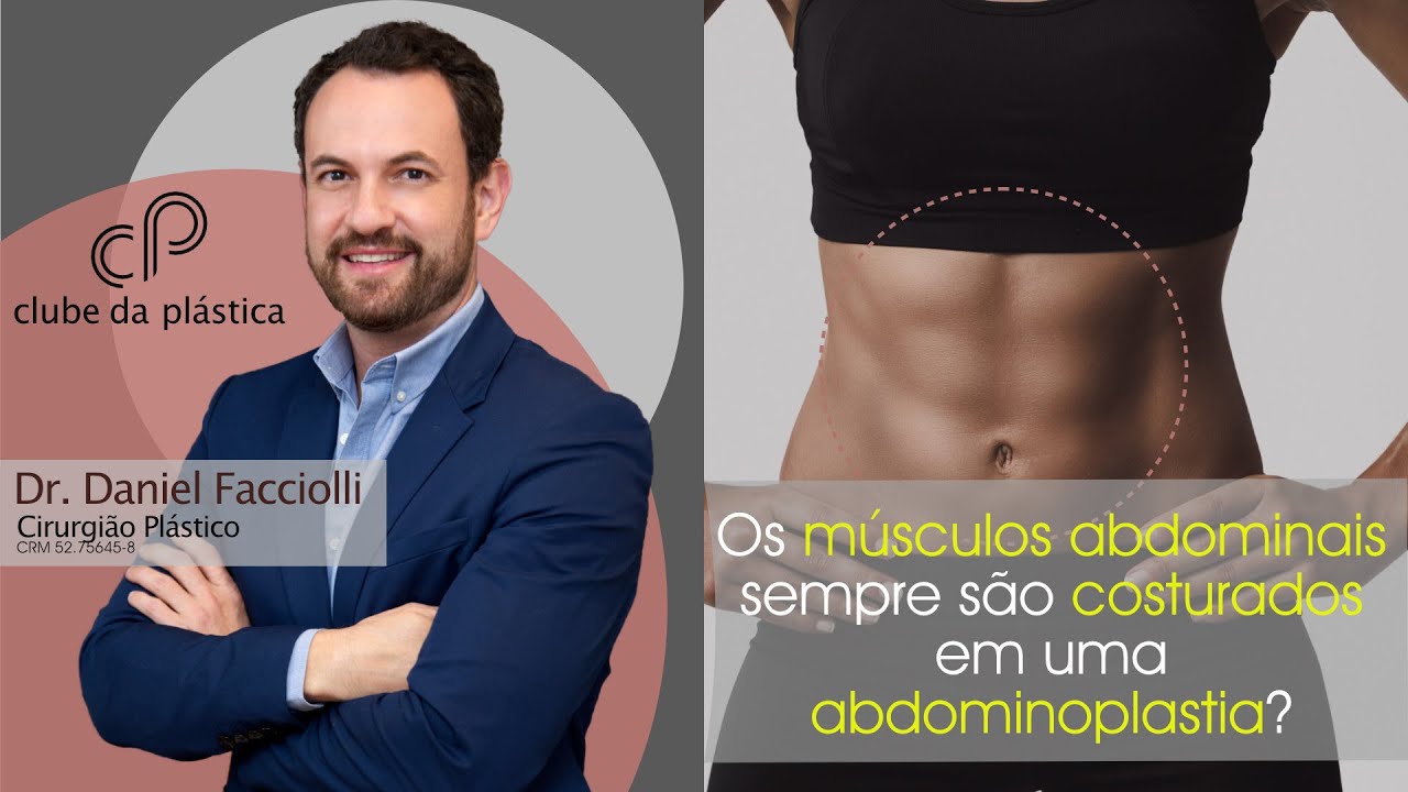 Clube da Plástica: Os músculos abdominais são sempre costurados em uma ...