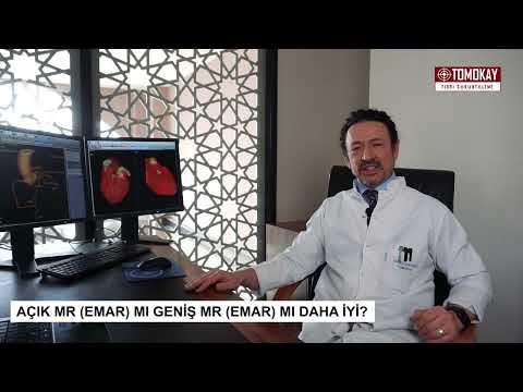 Açık Emar mı, Geniş Emar mı? Hangisi Daha iyi?