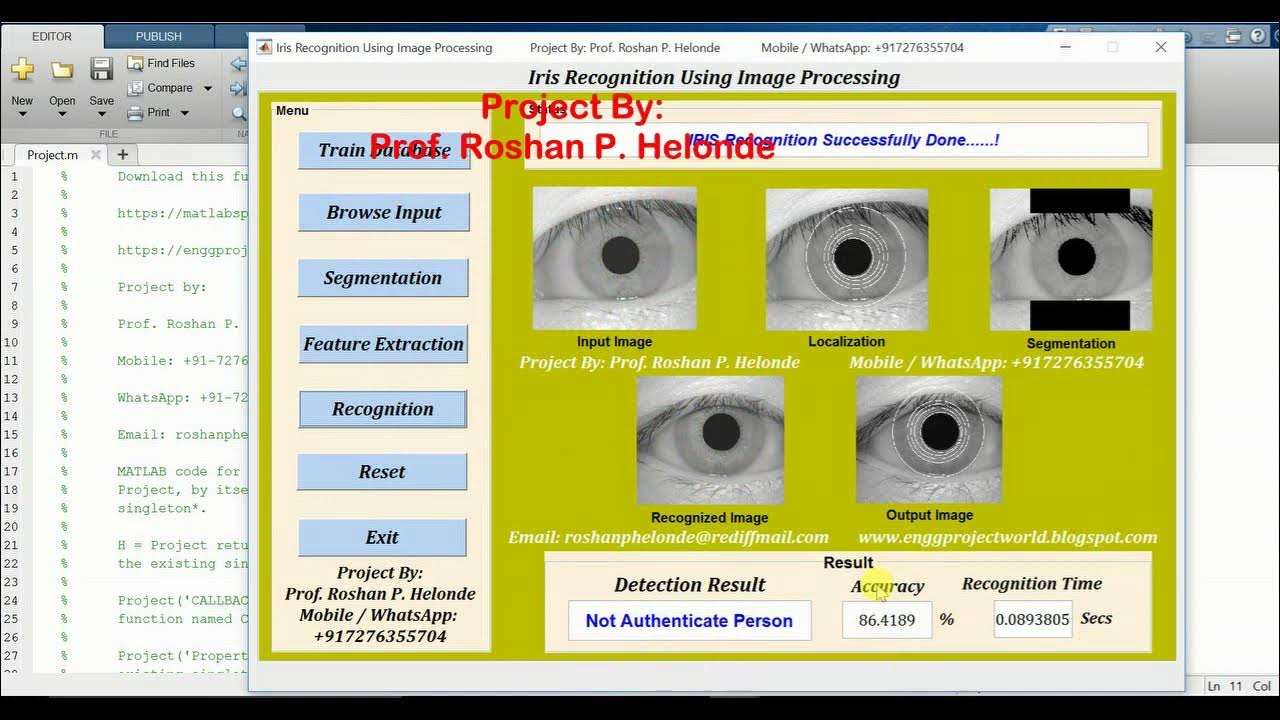 Iris Recognition Using Image Processing Matlab Project Source Code ...