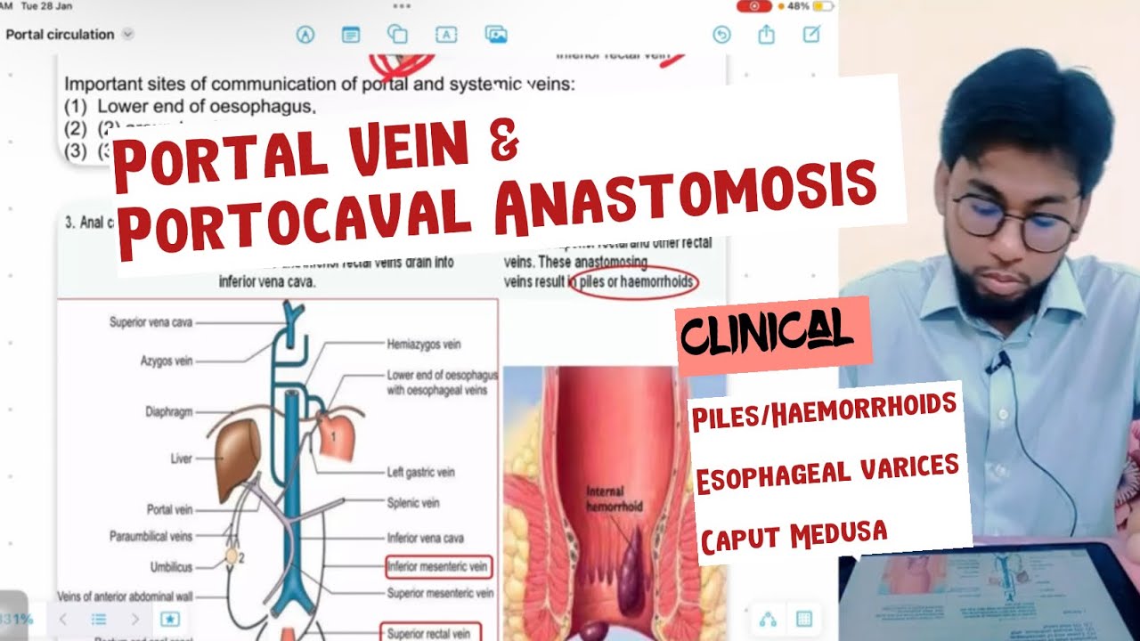 Portal Vein ,Portocaval Anastomosis And Clinical Anatomy - YouTube