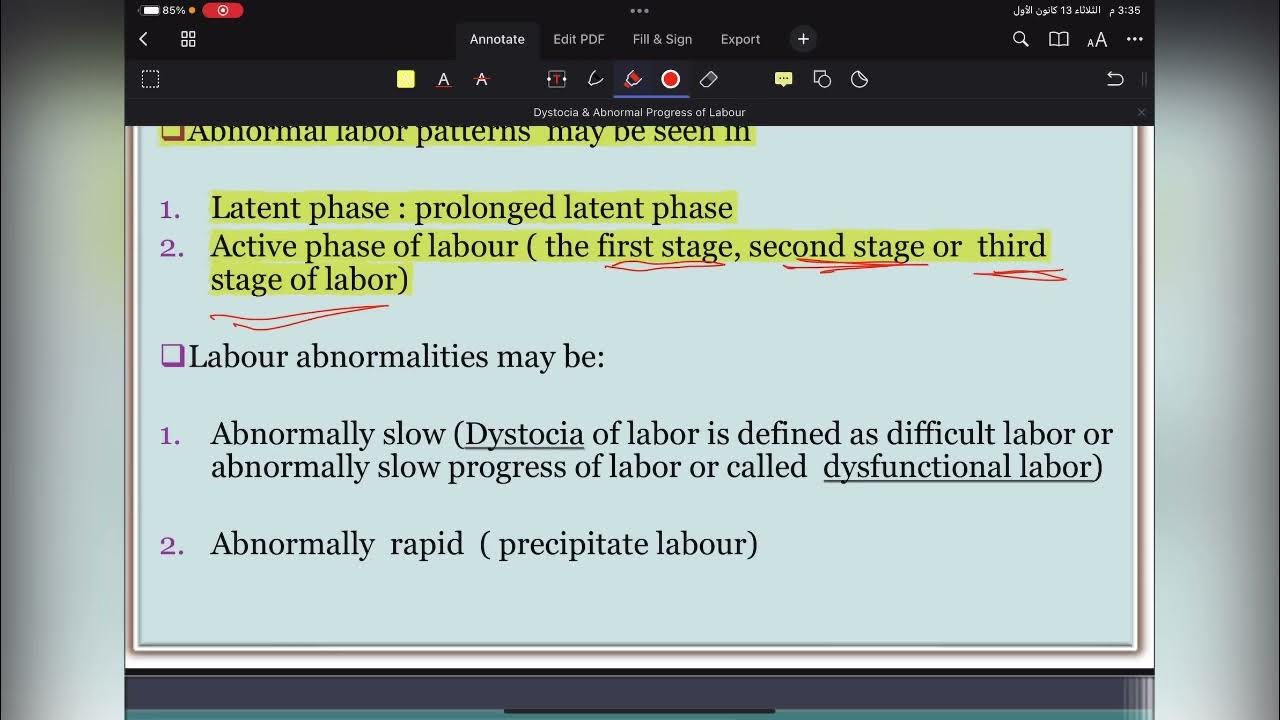 obstetrics lec / Dystocia and abnormal progress of labour - YouTube