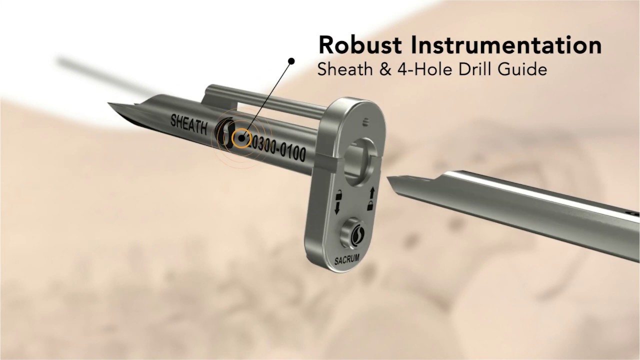 TransFasten Posterior Sacroiliac (SI) Joint Fusion System - Captiva ...