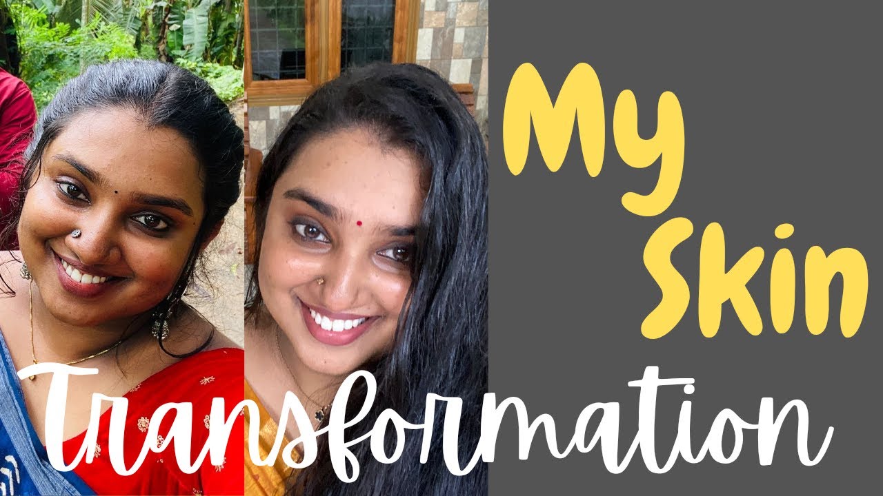 My skin transformation 😍🤗🤗 only home remedies 😍😍 - YouTube