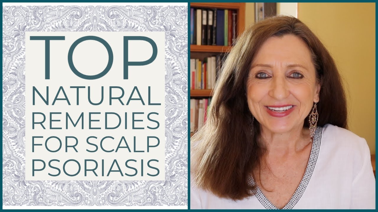 Top Natural Remedies For Scalp Psoriasis - Feb 1, 2020 - Medica Nova ...