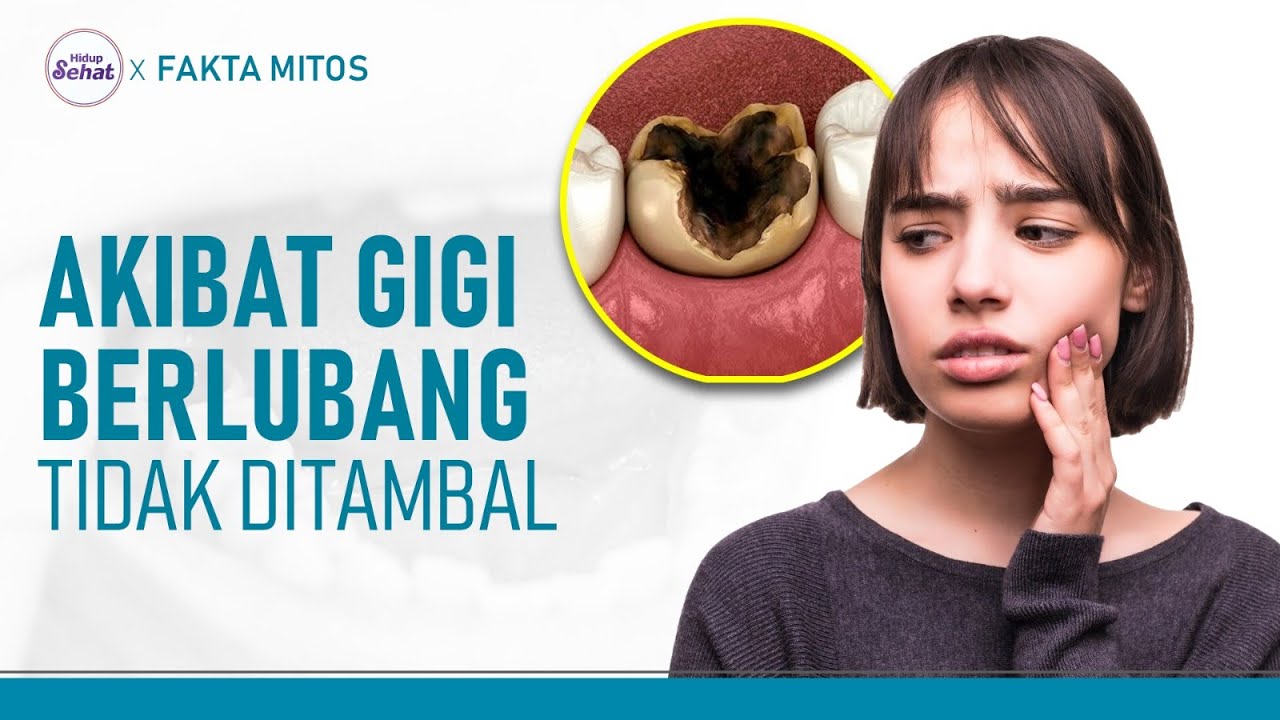 Ini Kenapa Gigi Berlubang Harus Ditambal | Hidup Sehat tvOne - YouTube