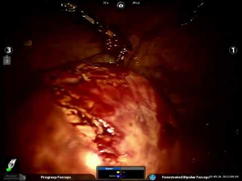 Robotic RPLND August 2013 - YouTube