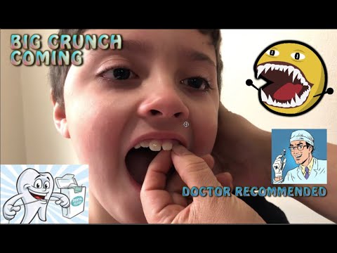 How To Pull A Loose Tooth | No Cry Teeth Pulling Method | Easily ...