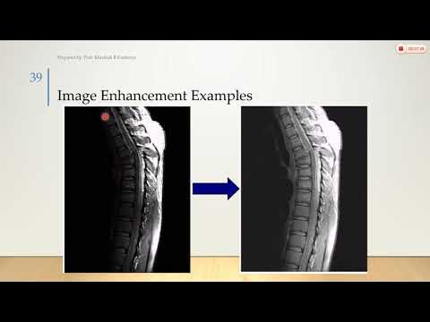 2_3 Image Enhancement || Key stages of Image Processing - YouTube