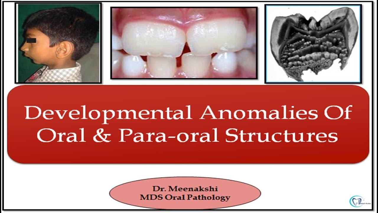 Introduction to Developmental Disturbances of oral and para-oral ...