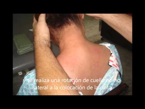 El Agular de la Escápula.wmv
