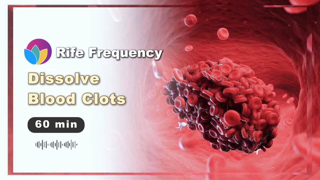 Assist Blood Flow & Reduce Clots | Thrombosis Support Rife Freq ...