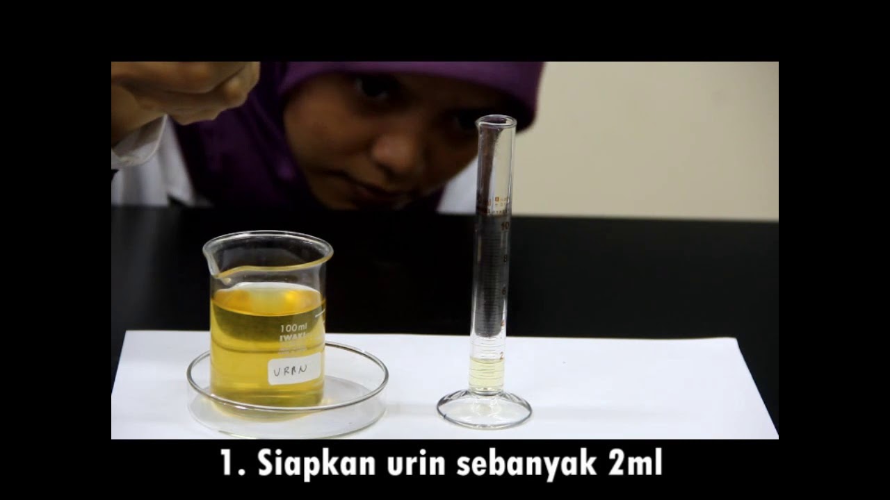 PRAKTIKUM UJI URIN - SISTEM EKSKRESI - YouTube