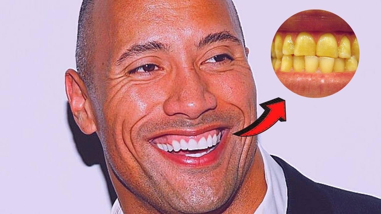 7 reasons Why Your Teeth Cannot Be as White as The Rock's Teeth - YouTube