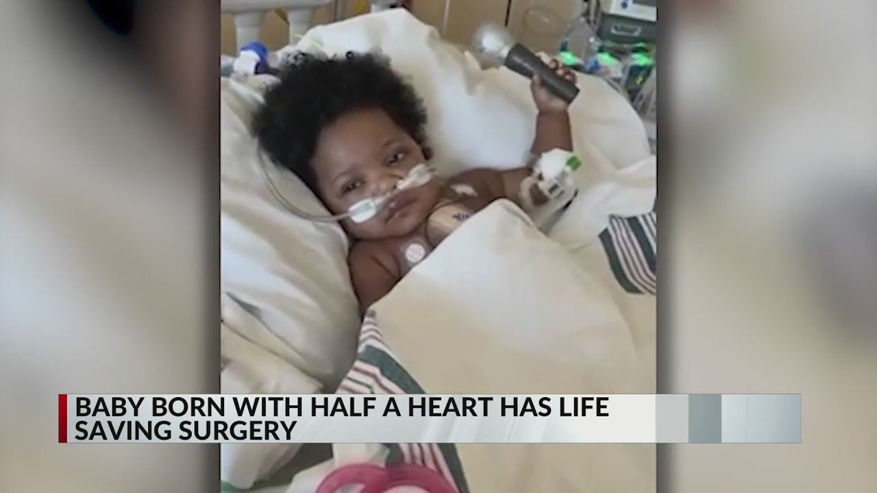 Mid-South baby born with half a heart gets life-saving surgery - YouTube