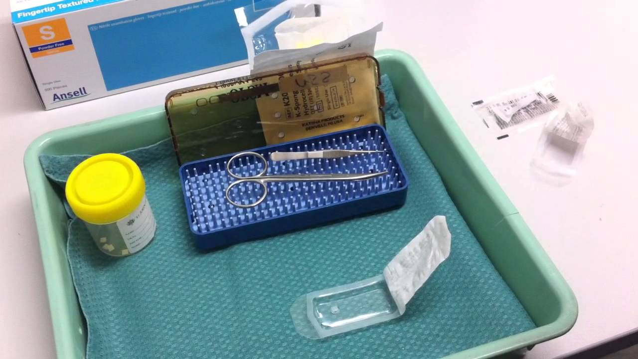 Ophthalmology: Eye Pledget Dilatation Procedure - YouTube