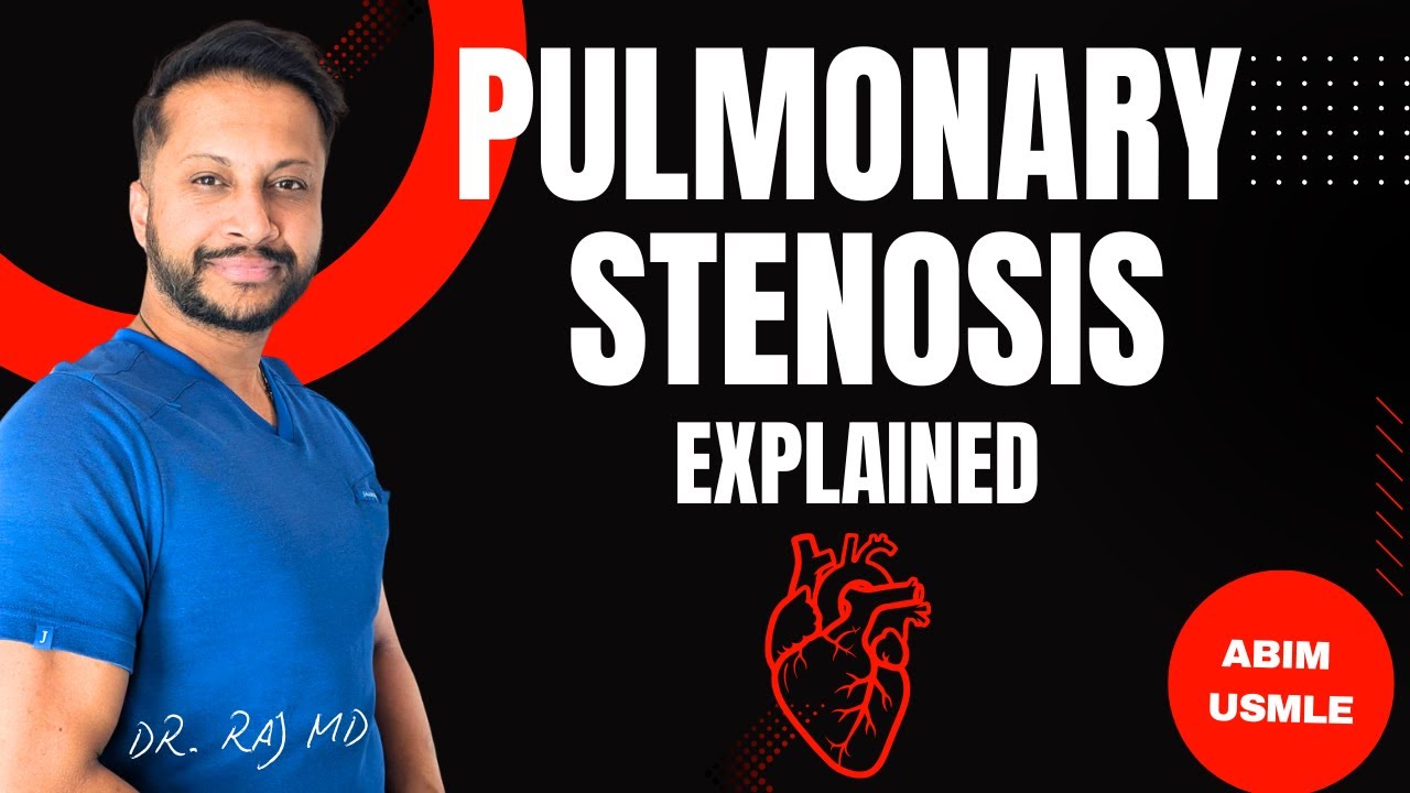 Pulmonary Stenosis | Cardiology | ABIM / USMLE - YouTube