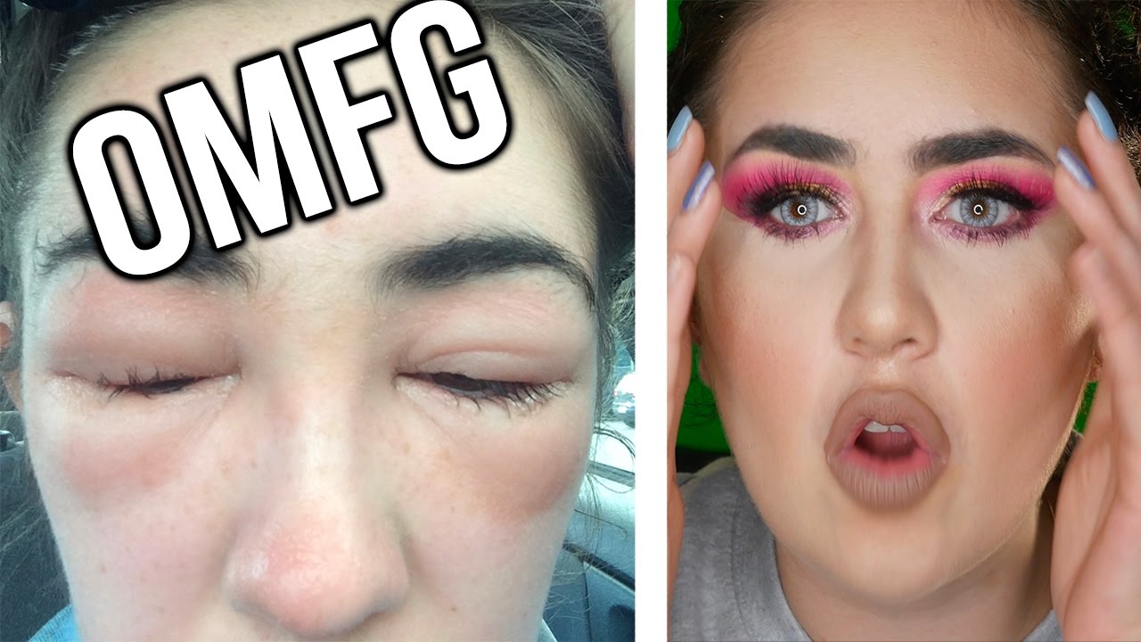 Allergic Reaction To Eye Makeup
