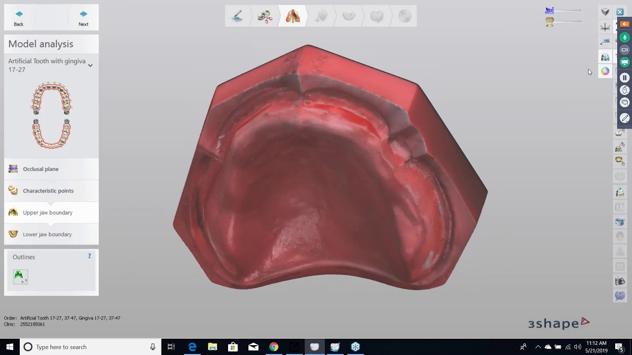 [Webinar] 3D Printing Digital Dentures with Dentca Resins – Part 2 with ...