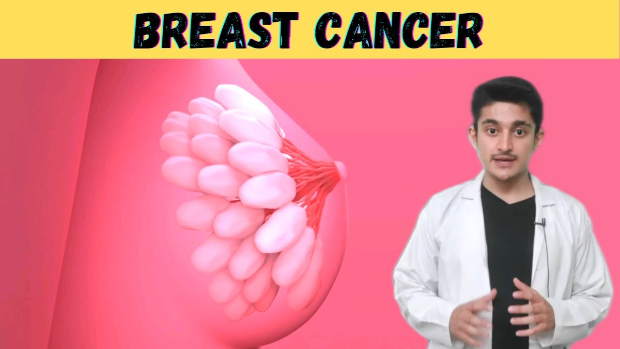 Breast cancer 3D animation | risk factor prevention | reduce risk ...