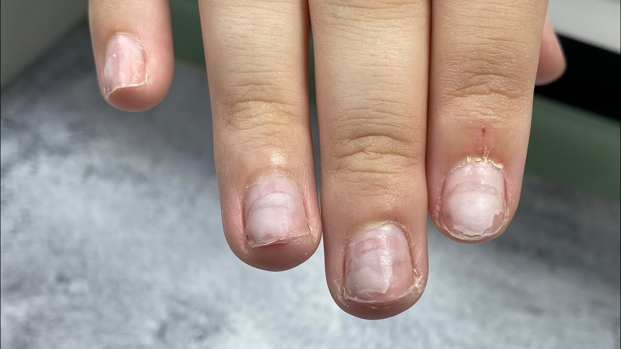 Triple-Your-Nails-Effortlessly-with-Dual-Form! - YouTube