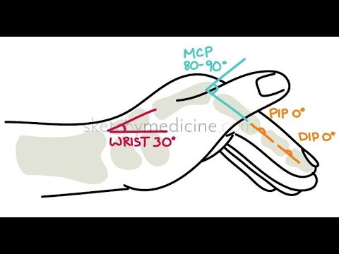 The Optimum position of the hand Position which ligaments of the hand ...