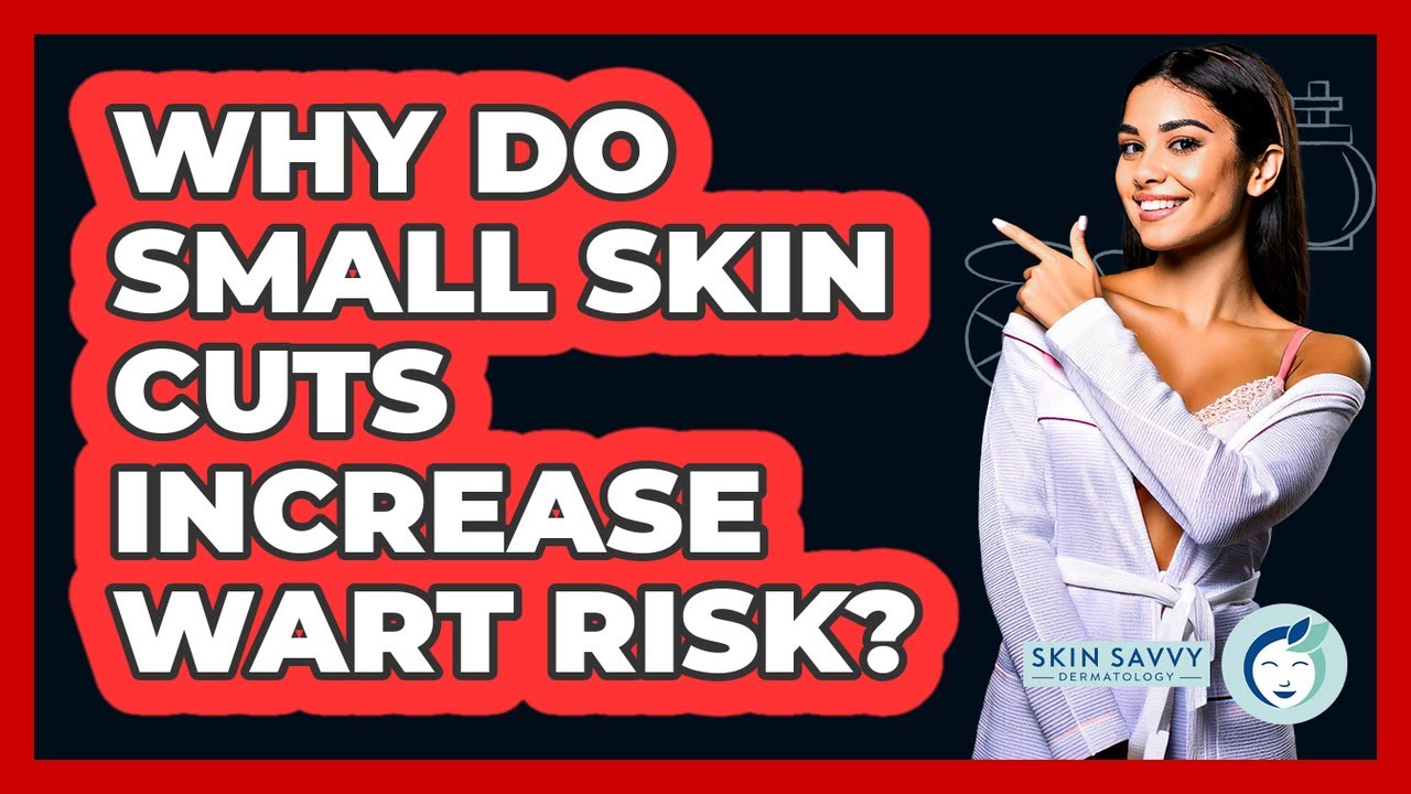 Why Do Small Skin Cuts Increase Wart Risk? - Skin Savvy Dermatology ...