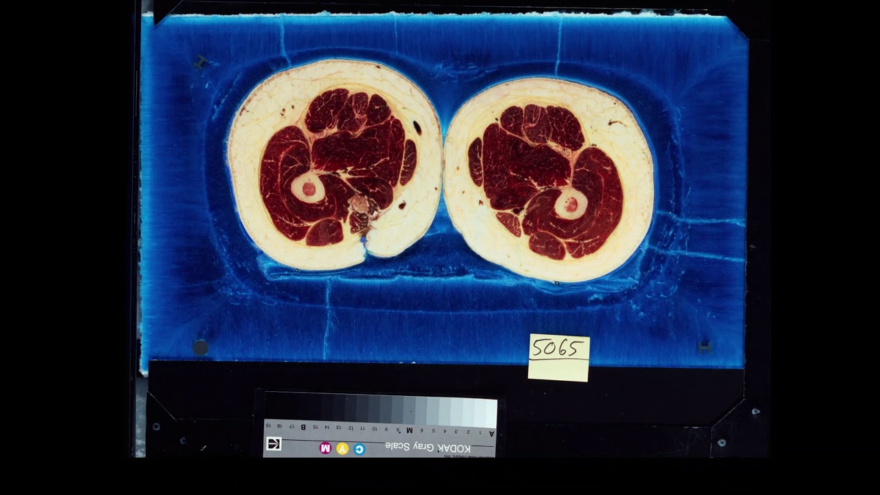 Visual Human Project Female Cadaver 4k60FPS - YouTube