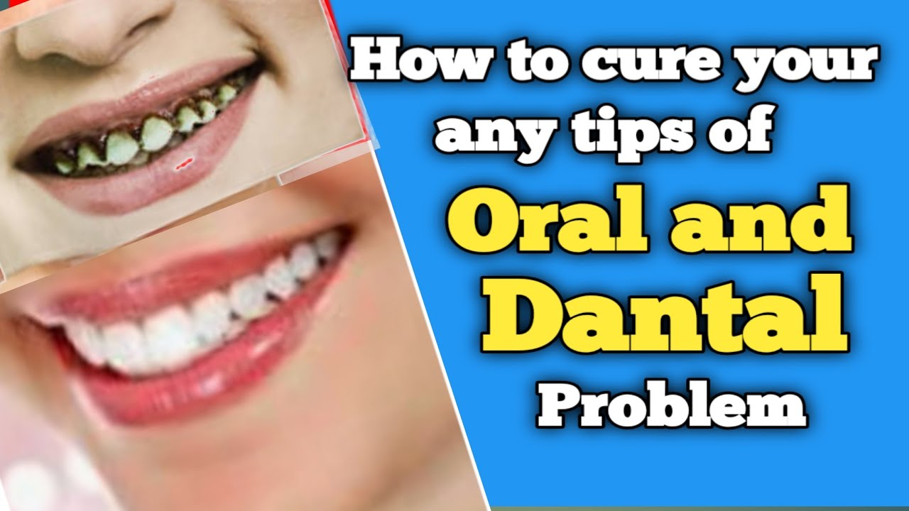 How to Cure any types of Oral and Dantal Problem, Fresh O Guard ...