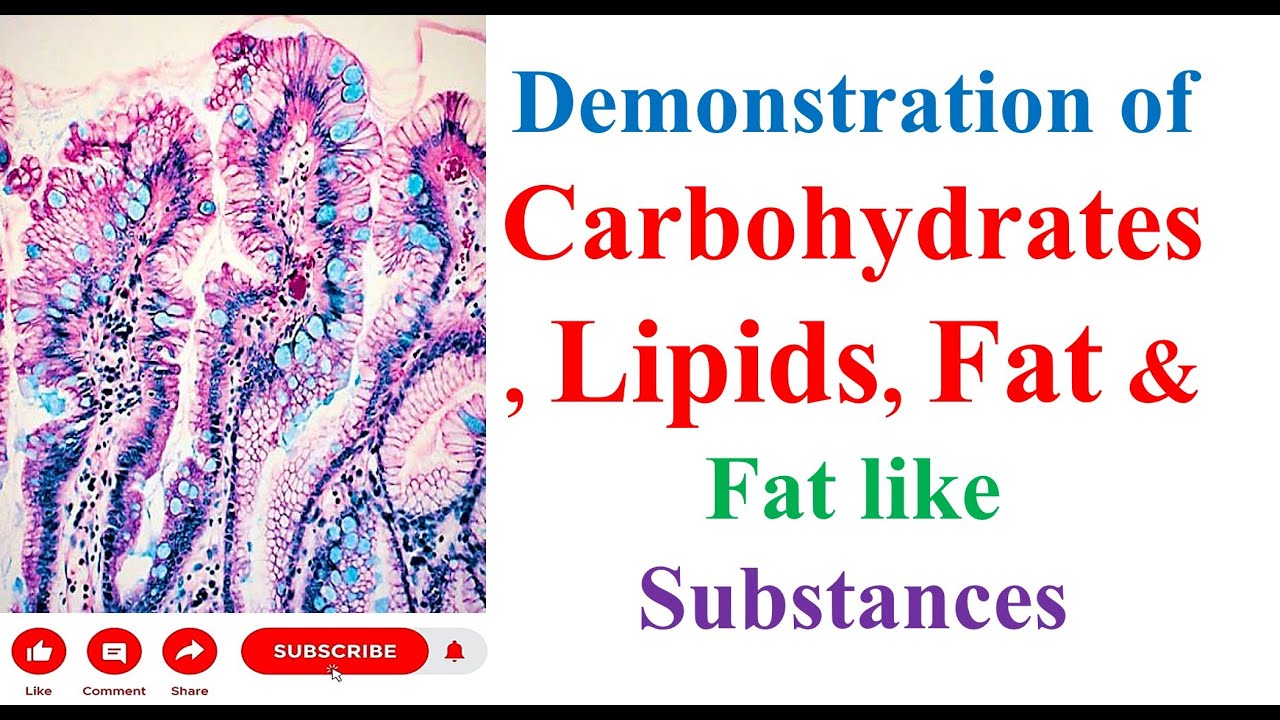 #Demonstration of Carbohydrates Lipids, Fat & Fat like Substances. #MLT ...